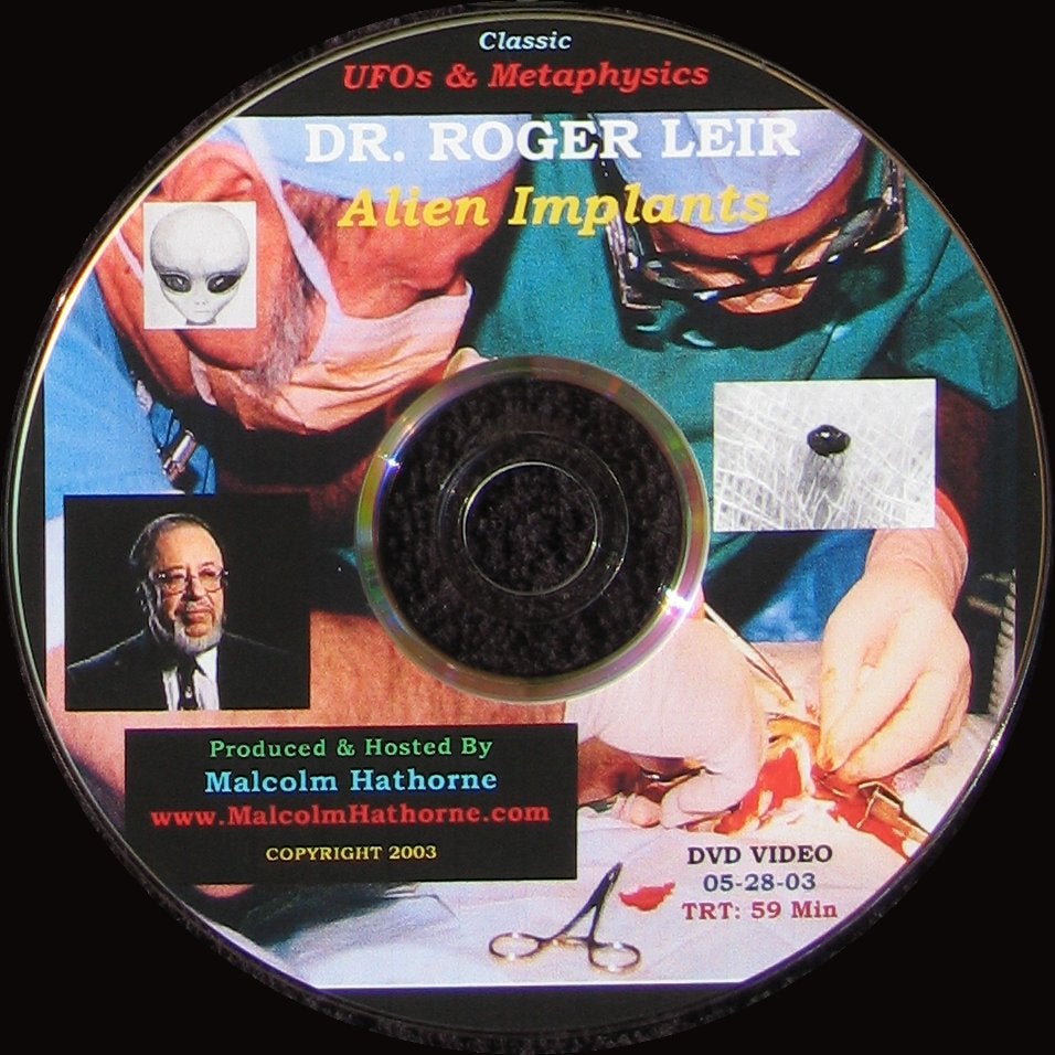 DR, ROGER LEIR - ALIEN IMPLANT REMOVALS - Payhip