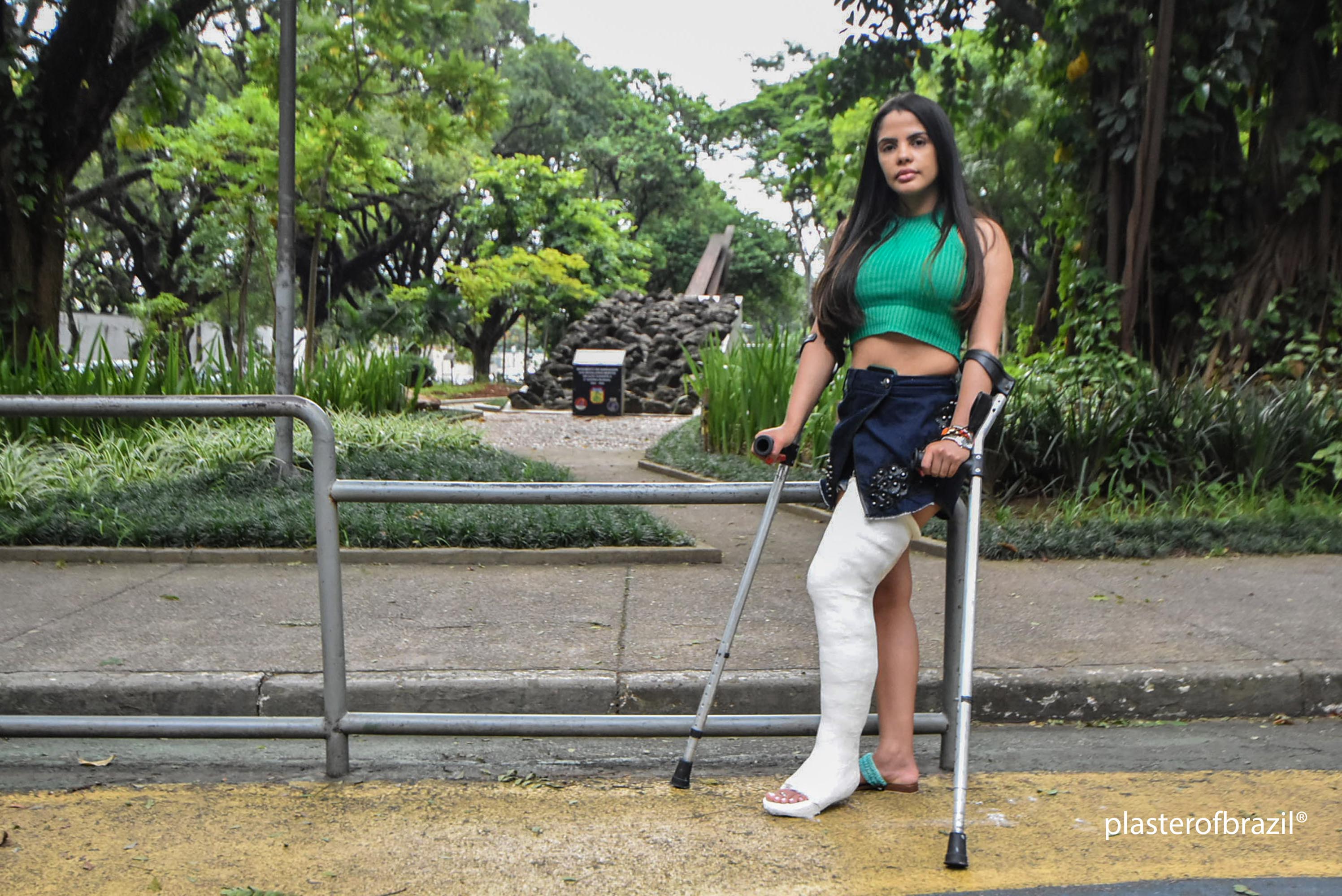 Thaynara Long Leg Cast - going to walk on crutches in a very beautiful ...