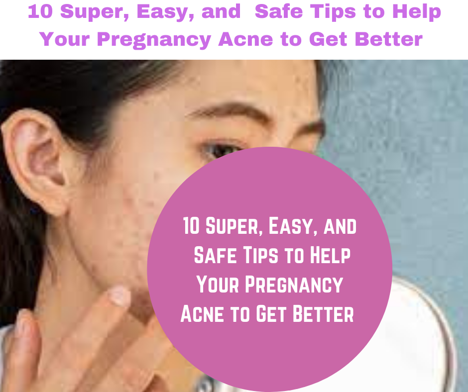 10 Super, Easy, and Safe Tips to Help Your Pregnancy Acne to Get Better - Payhip